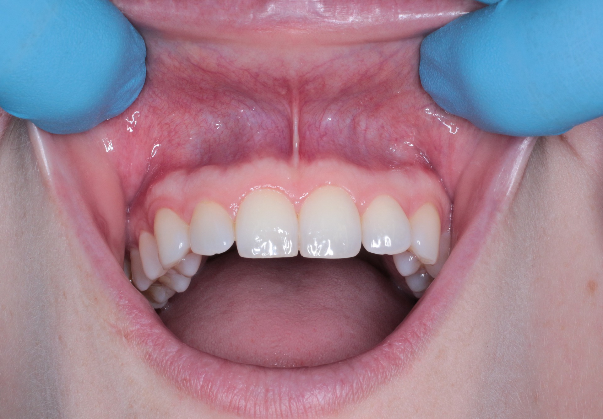 Oral cancer – College of General Dentistry